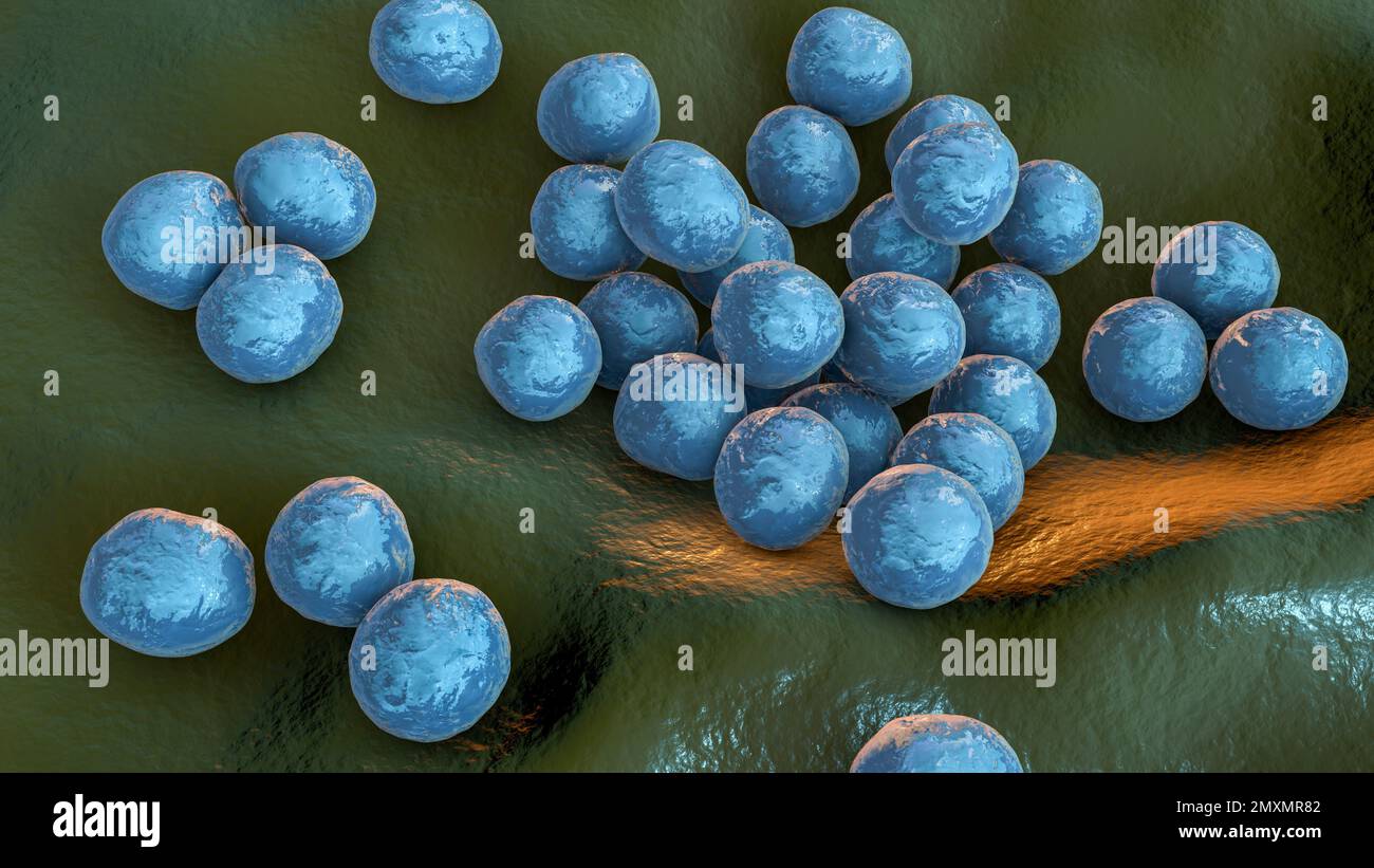 Infezioni cutanee da stafilococco immagini e fotografie stock ad alta risoluzione - Alamy