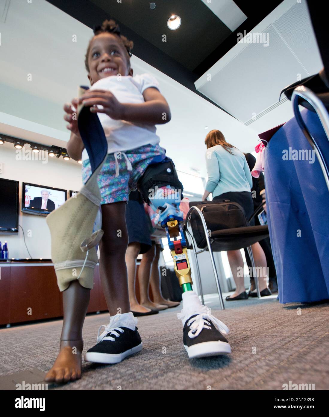Miyah Williams, 3, holding her old prosthesis, shows her new one she’s ...