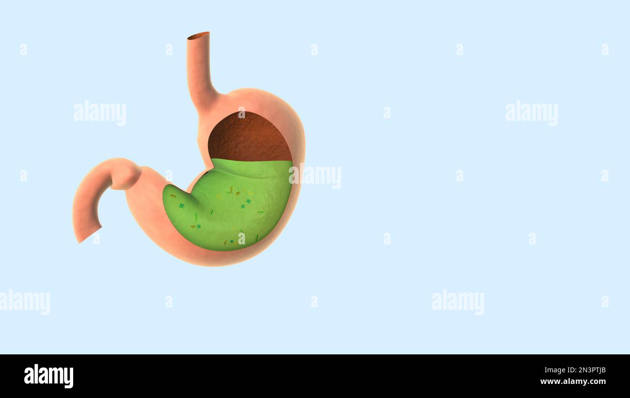 Stomaco acido immagini e fotografie stock ad alta risoluzione - Alamy