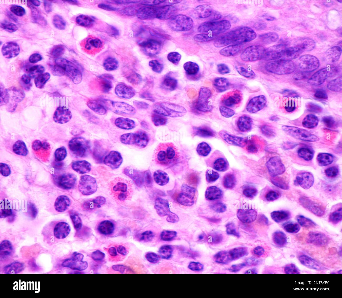 Micrografia al microscopio ottico che mostra granulociti eosinofili ...