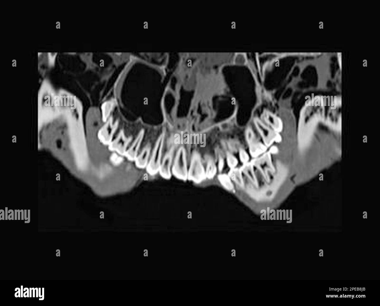A picture distributed by Egyptian antiquities authority showing CT scan ...