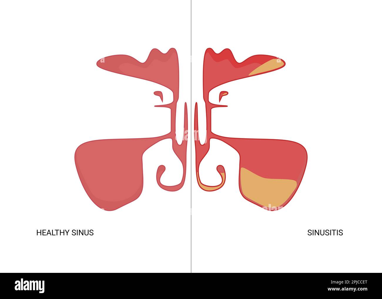 Anatomia del naso e seni paranasali immagini e fotografie stock ad alta ...