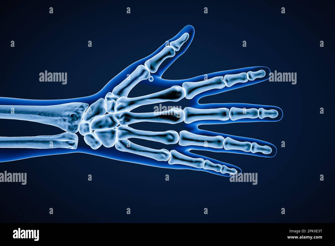Vista dorsale o posteriore radiografica delle ossa della mano umana ...