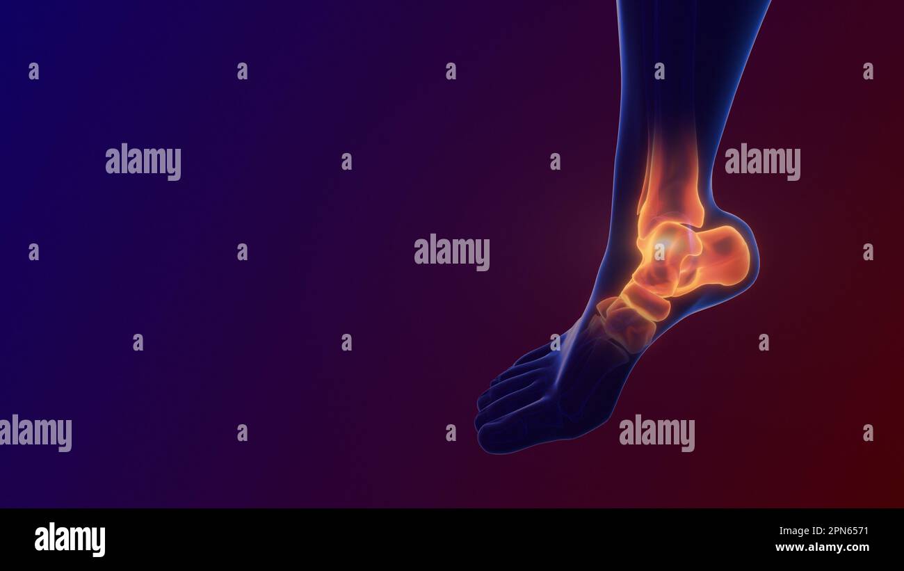 Ankle joint immagini e fotografie stock ad alta risoluzione - Alamy