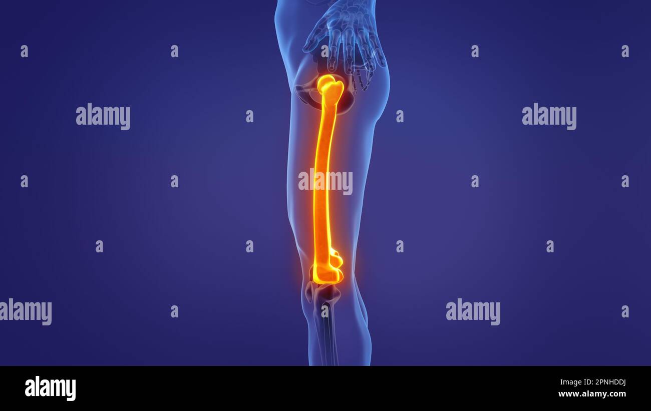 Radiografia frattura dell'anca immagini e fotografie stock ad alta ...