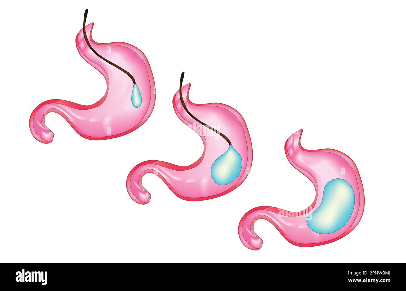Stomaco addome Immagini Vettoriali Stock - Alamy