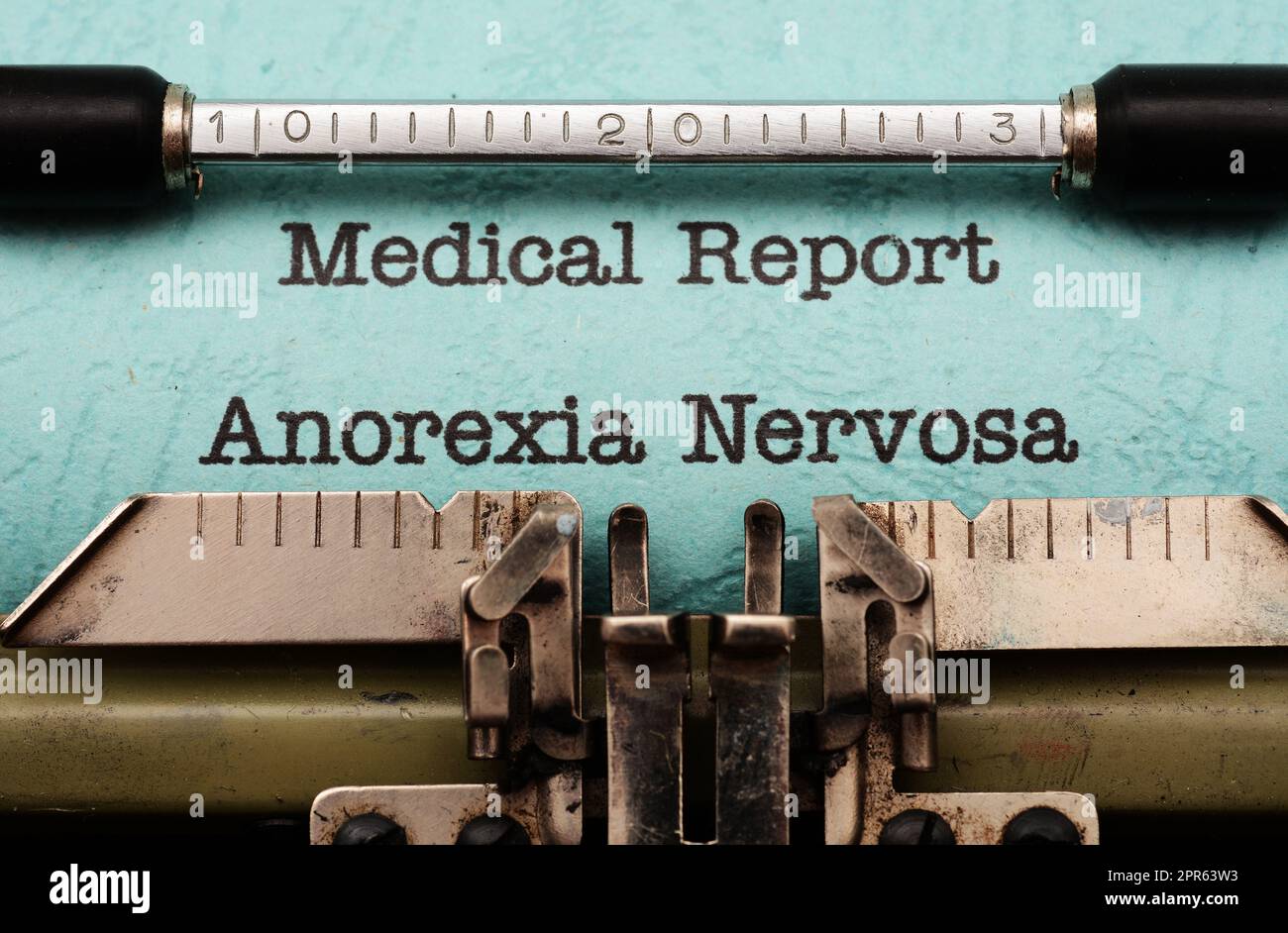 Anoressia nervosa immagini e fotografie stock ad alta risoluzione - Alamy