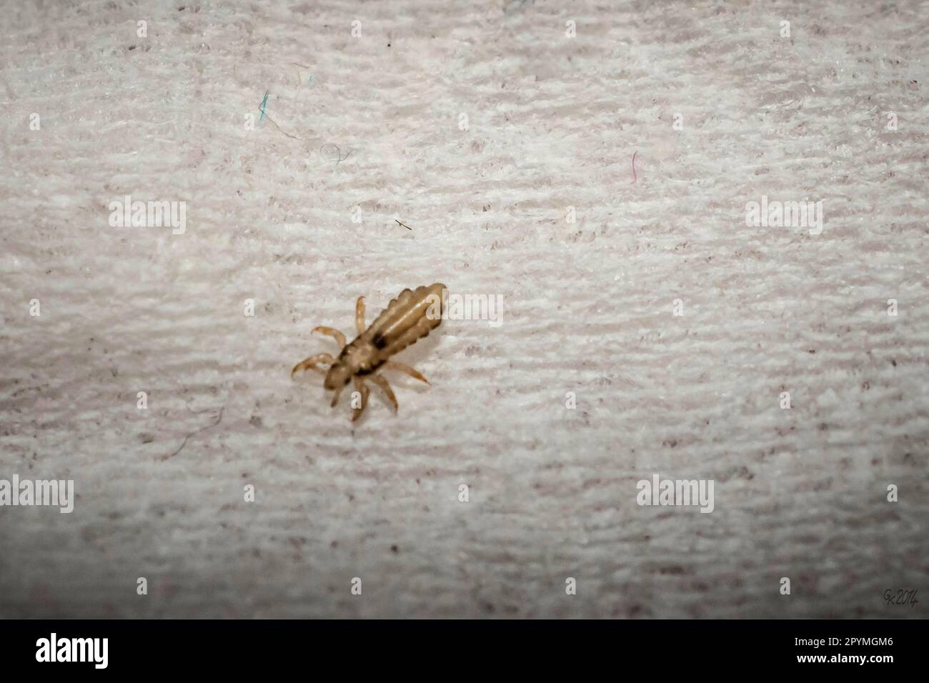 Pidocchio della testa umana immagini e fotografie stock ad alta ...