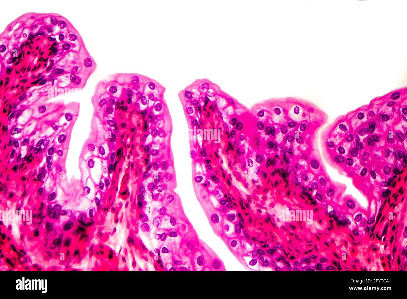 Tessuto epiteliale transitorio della vescica urinaria al microscopio ...