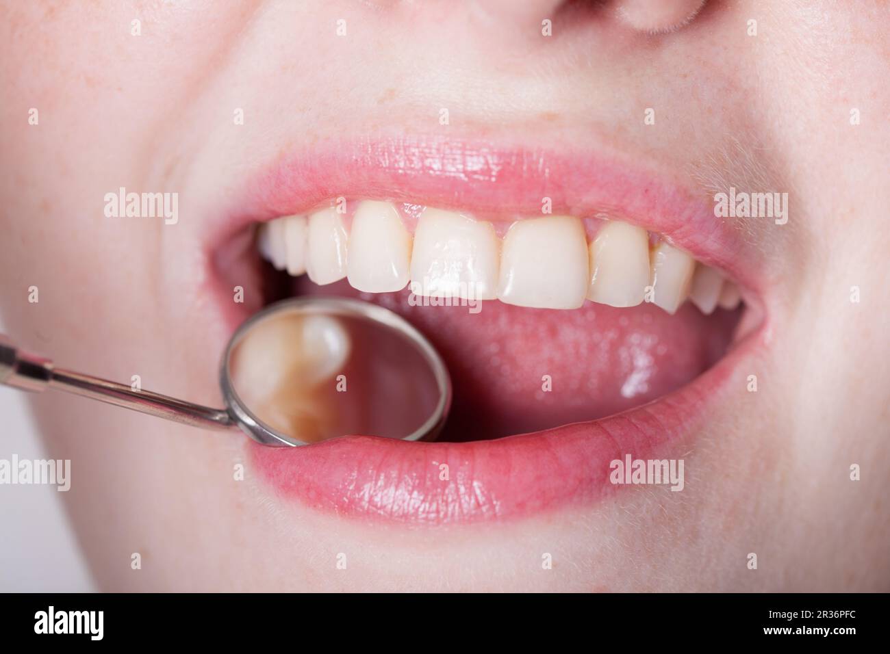 Ispezione dei denti immagini e fotografie stock ad alta risoluzione - Alamy