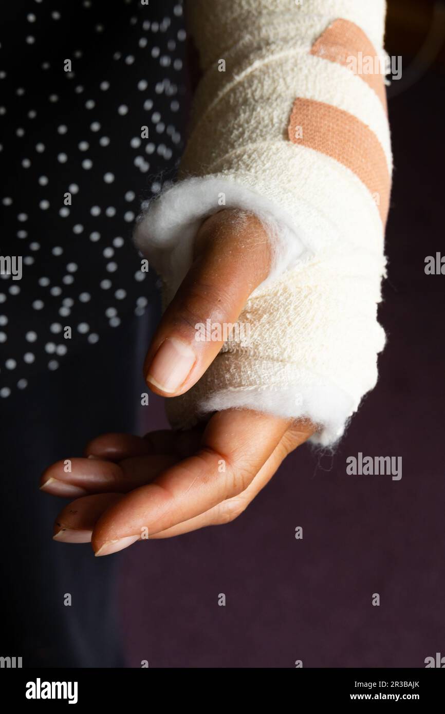 Polso ingessato immagini e fotografie stock ad alta risoluzione - Alamy