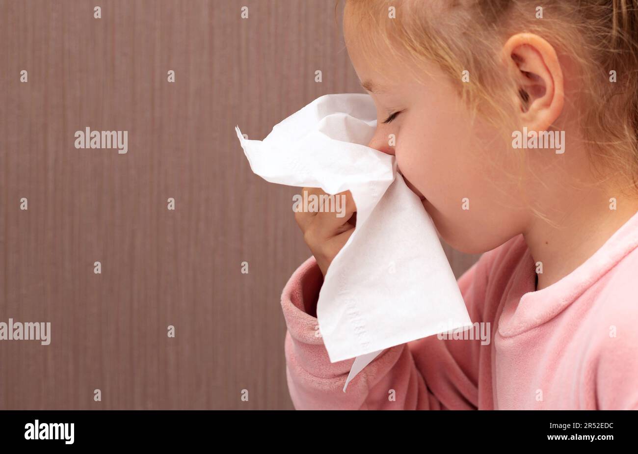la bambina ha un naso che cola e soffia il naso in un fazzoletto di ...