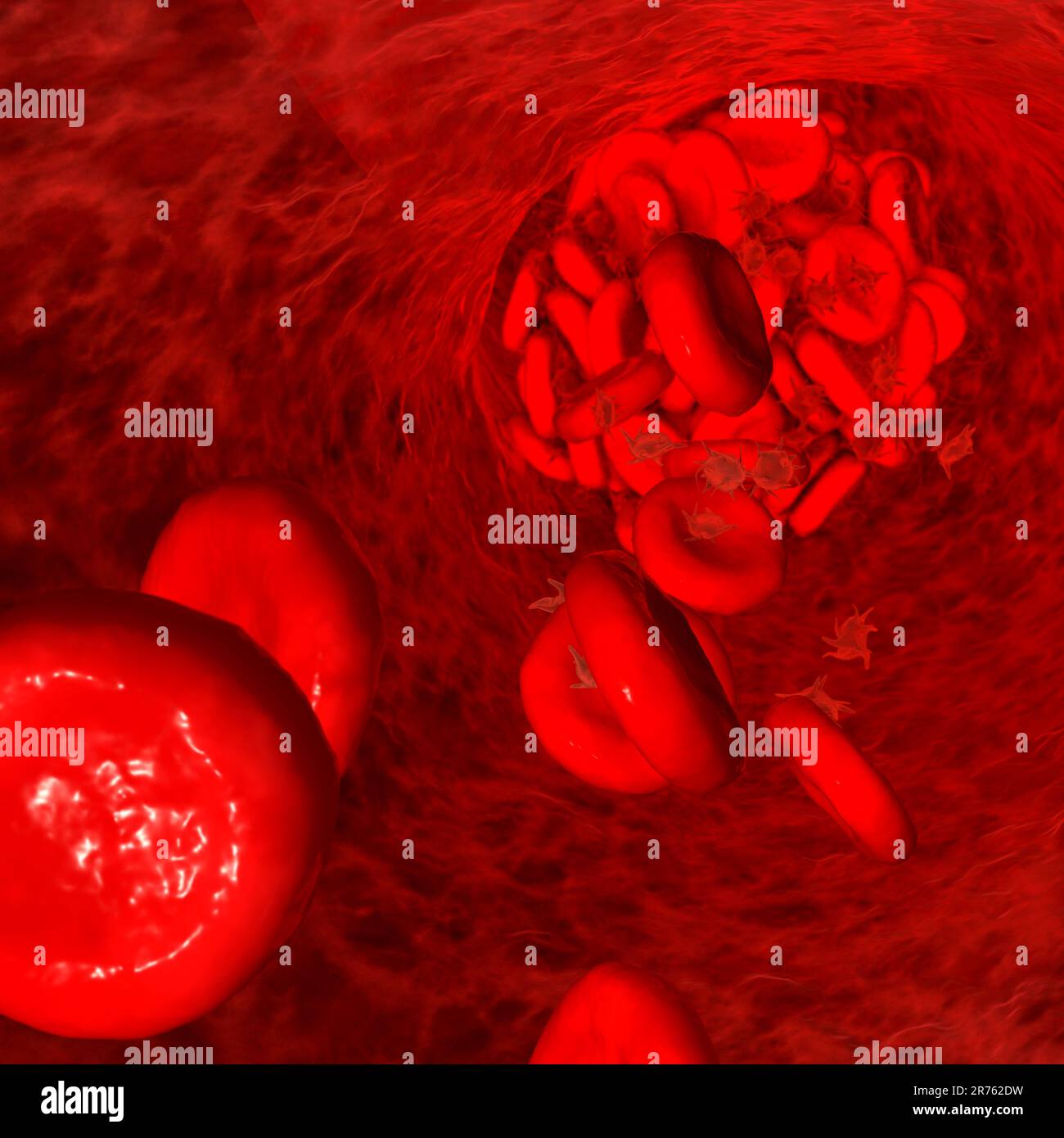 Rischio di coaguli di sangue da coronavirus immagini e fotografie stock ...