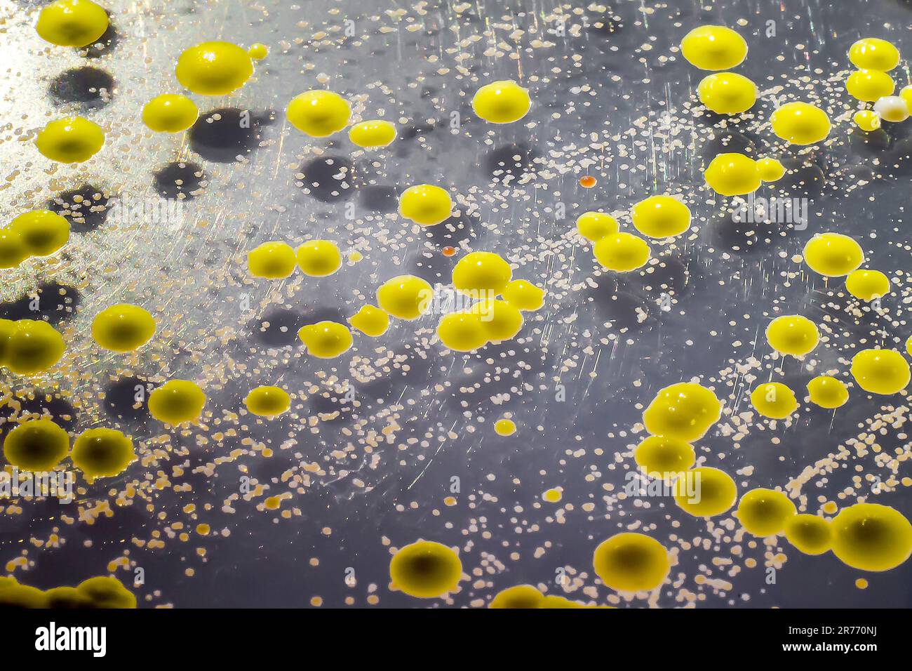 Batteri cresciuti da uno striscio cutaneo, colonie di Micrococcus ...