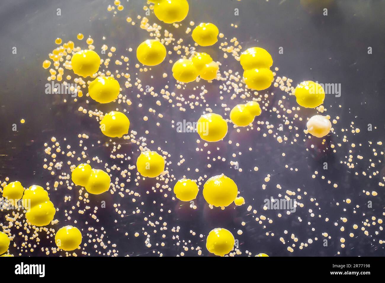 Batteri cresciuti da uno striscio cutaneo, colonie di Micrococcus ...