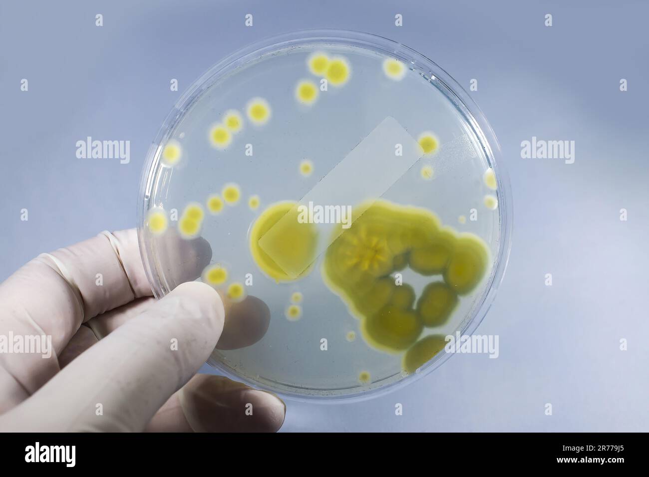 Sabouraud dextrose agar immagini e fotografie stock ad alta risoluzione - Alamy