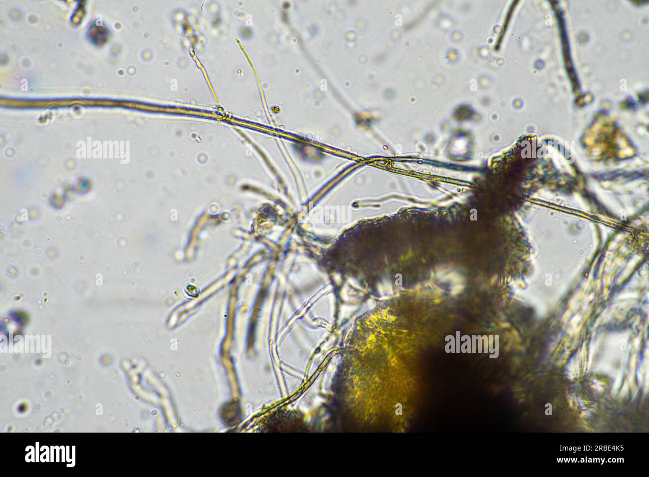 Célula epitelial microscopio immagini e fotografie stock ad alta ...