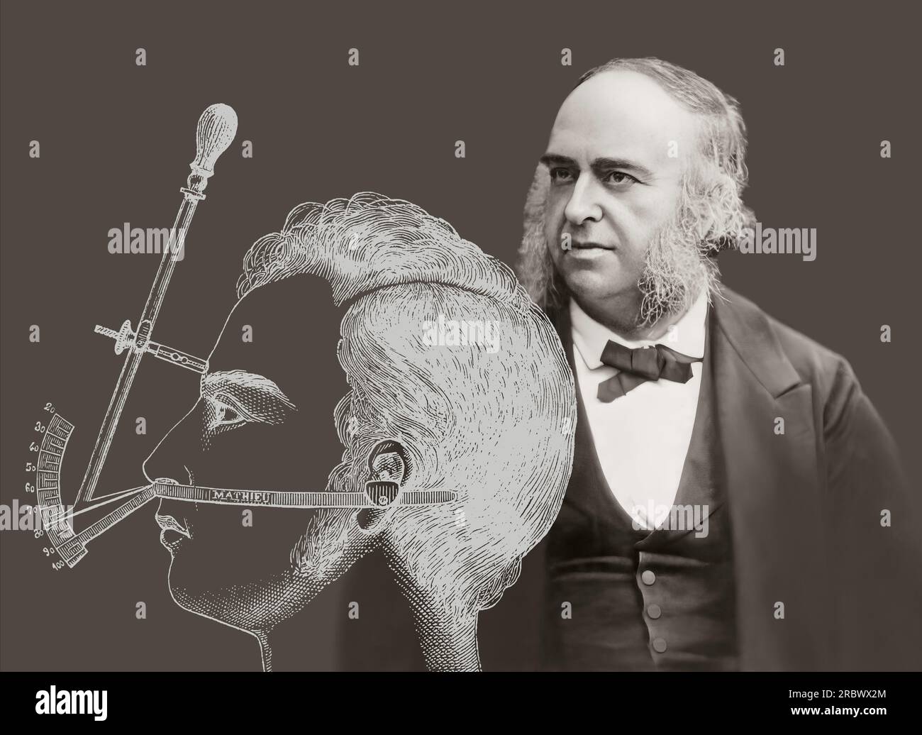 Goniometro facciale immagini e fotografie stock ad alta risoluzione - Alamy