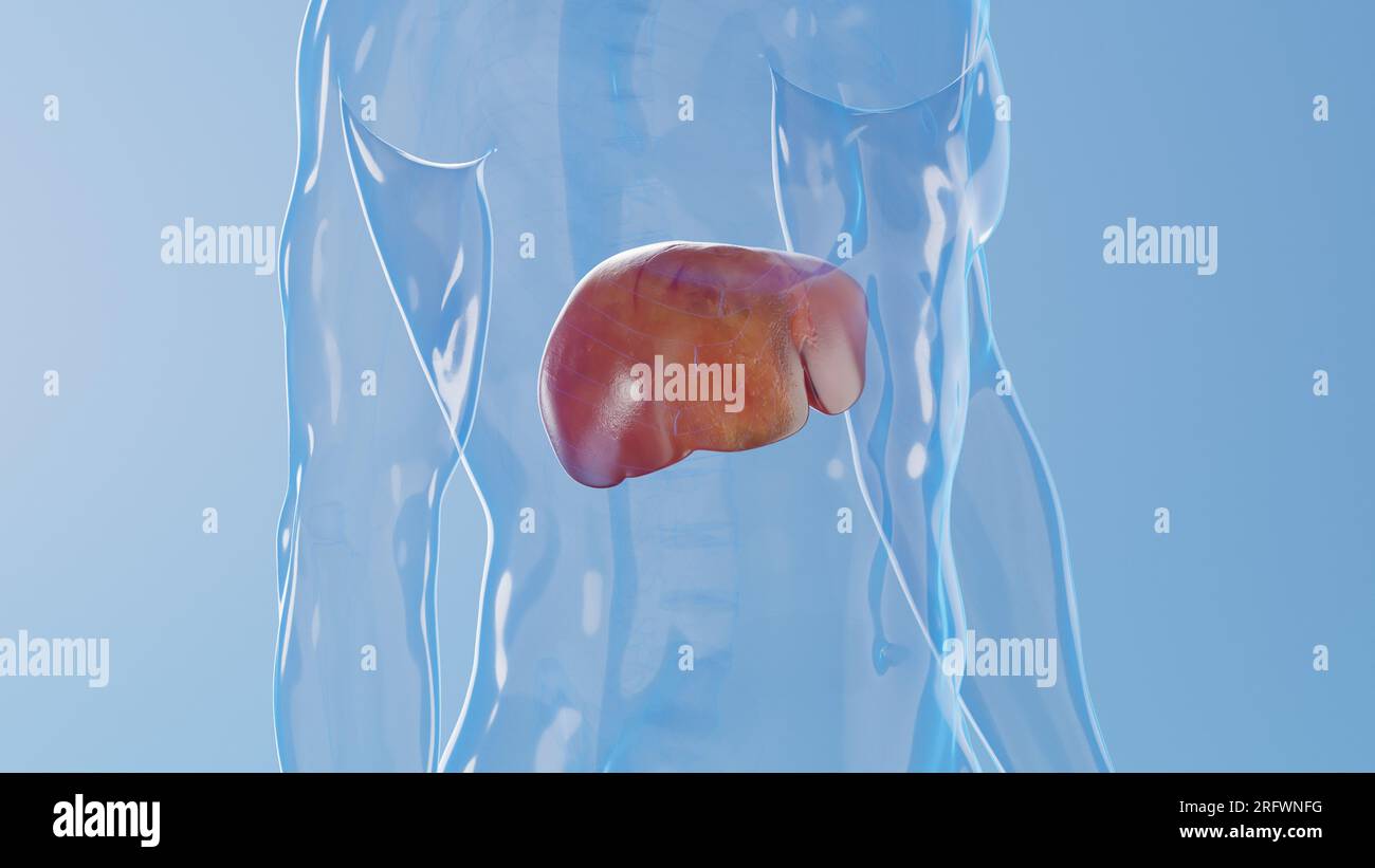 Lobo sinistro del fegato immagini e fotografie stock ad alta ...