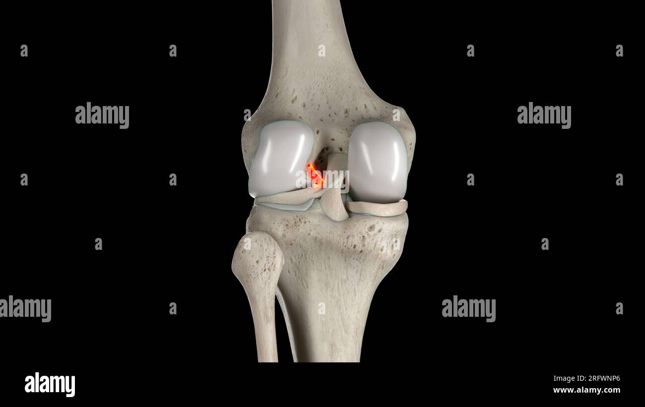 Crociato anteriore immagini e fotografie stock ad alta risoluzione - Alamy