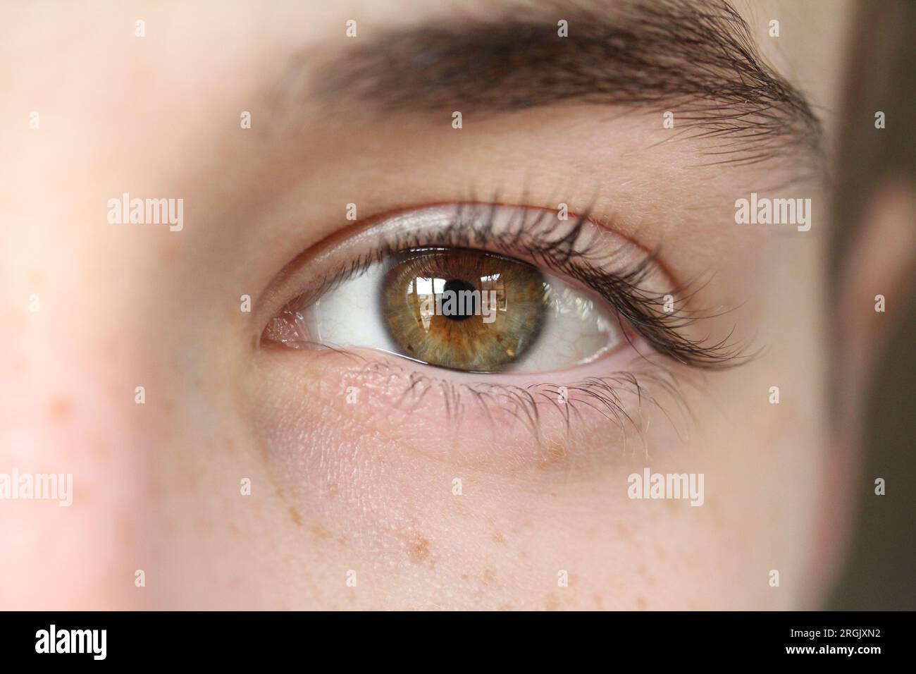 Central heterochromia immagini e fotografie stock ad alta risoluzione ...