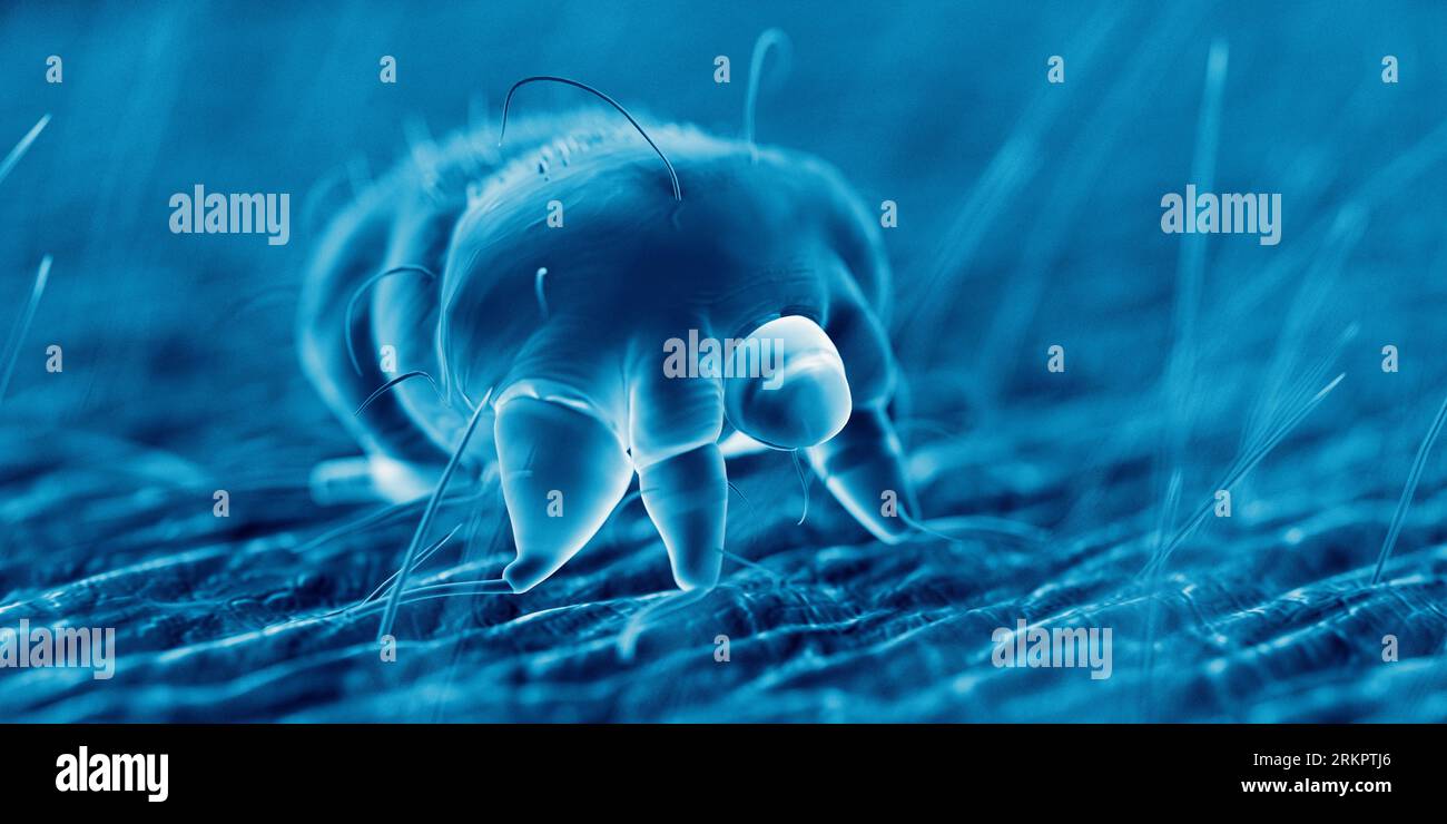 Acaro della scabbia sulla pelle umana immagini e fotografie stock ad ...