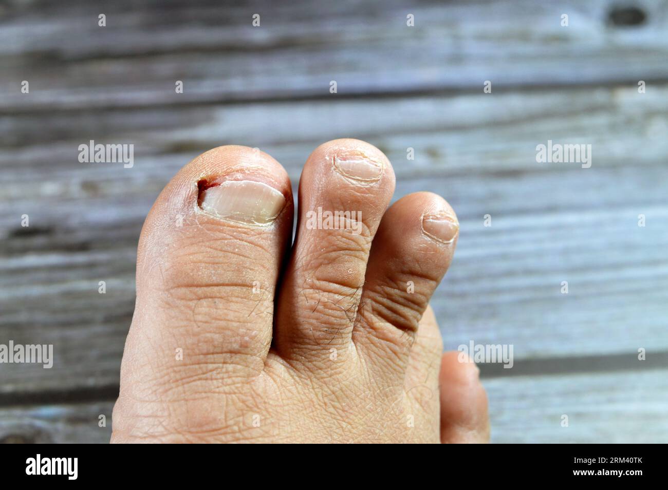 Ossa di un piede destro umano immagini e fotografie stock ad alta ...