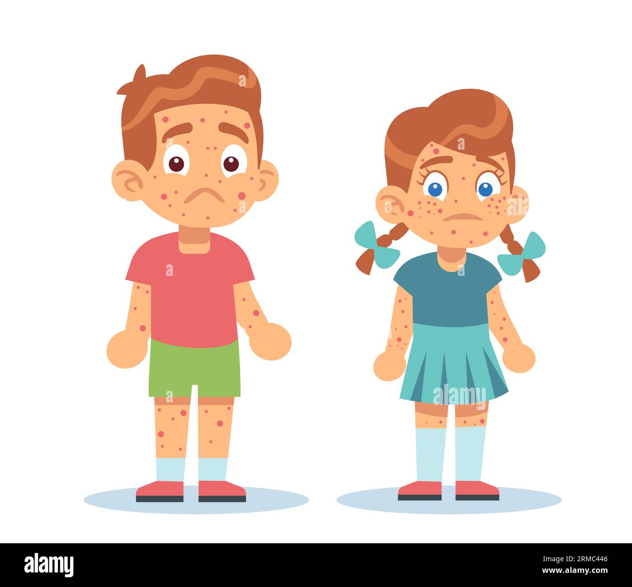 Dermatite atopica bambini Immagini Vettoriali Stock - Alamy