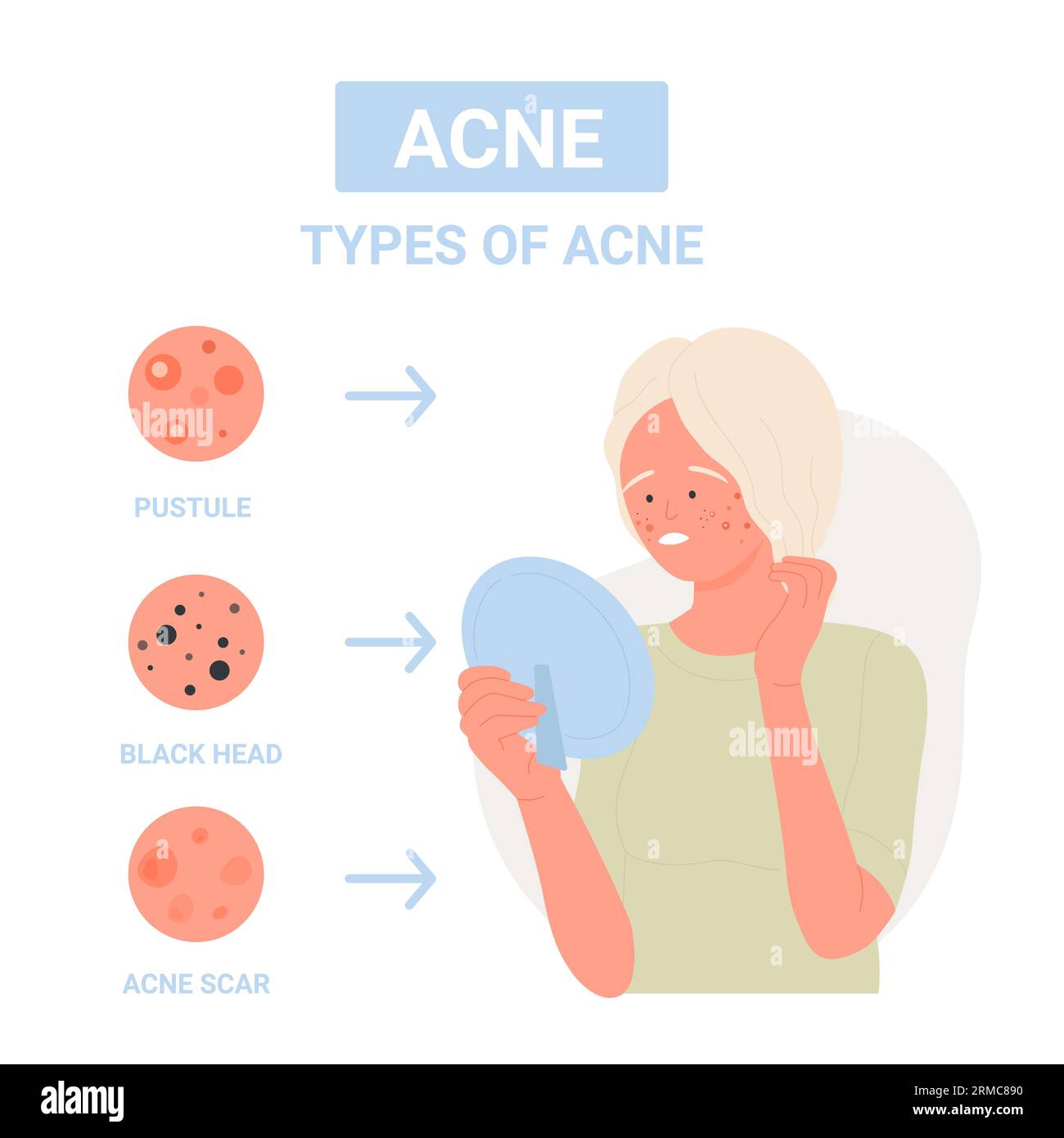Types of bacteria disease immagini e fotografie stock ad alta ...