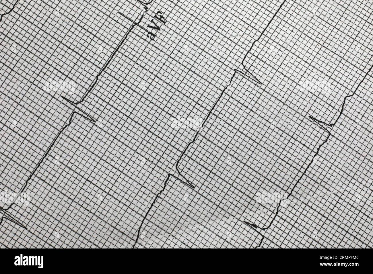 Screening cardiaco immagini e fotografie stock ad alta risoluzione - Alamy