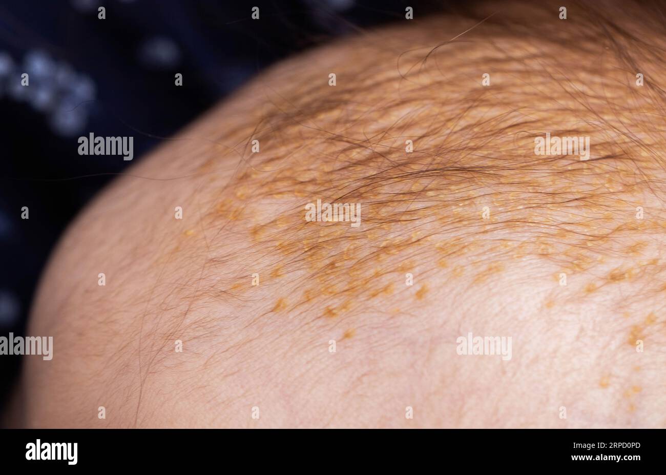 Croste di latte immagini e fotografie stock ad alta risoluzione - Alamy