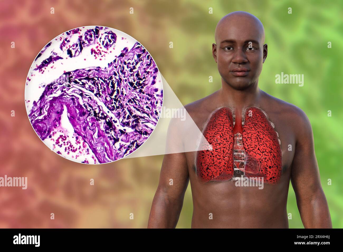 Anatomia e istologia dei polmoni umani immagini e fotografie stock ad ...