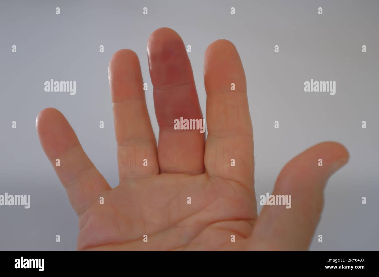 Dito dito immagini e fotografie stock ad alta risoluzione - Alamy