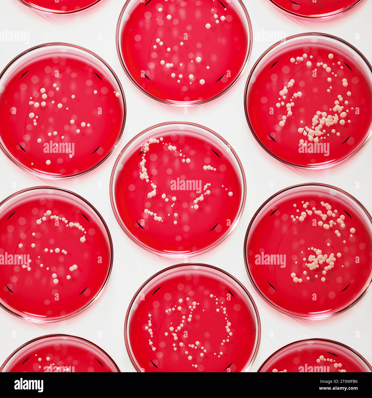 Staphylococcus agar immagini e fotografie stock ad alta risoluzione - Alamy