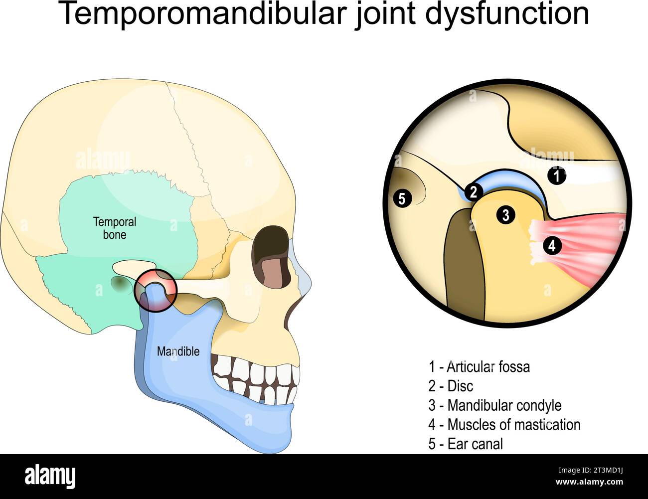 Temporomandibular joint Immagini Vettoriali Stock - Alamy