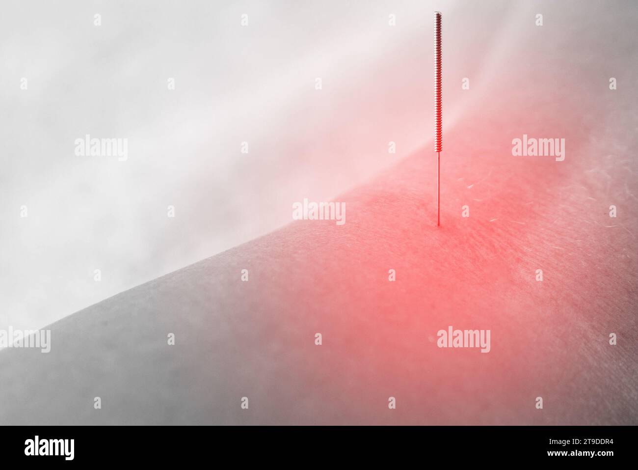 Fossa popliteo immagini e fotografie stock ad alta risoluzione - Alamy