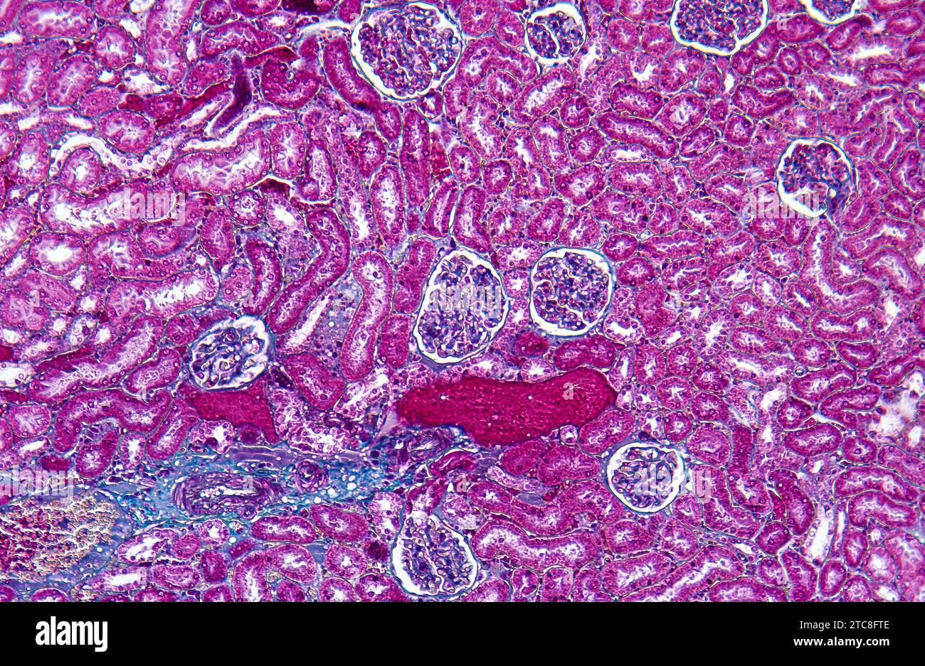 Renal tubule immagini e fotografie stock ad alta risoluzione - Alamy