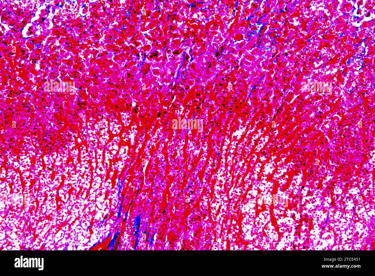Glandula suprarrenal histologia immagini e fotografie stock ad alta ...