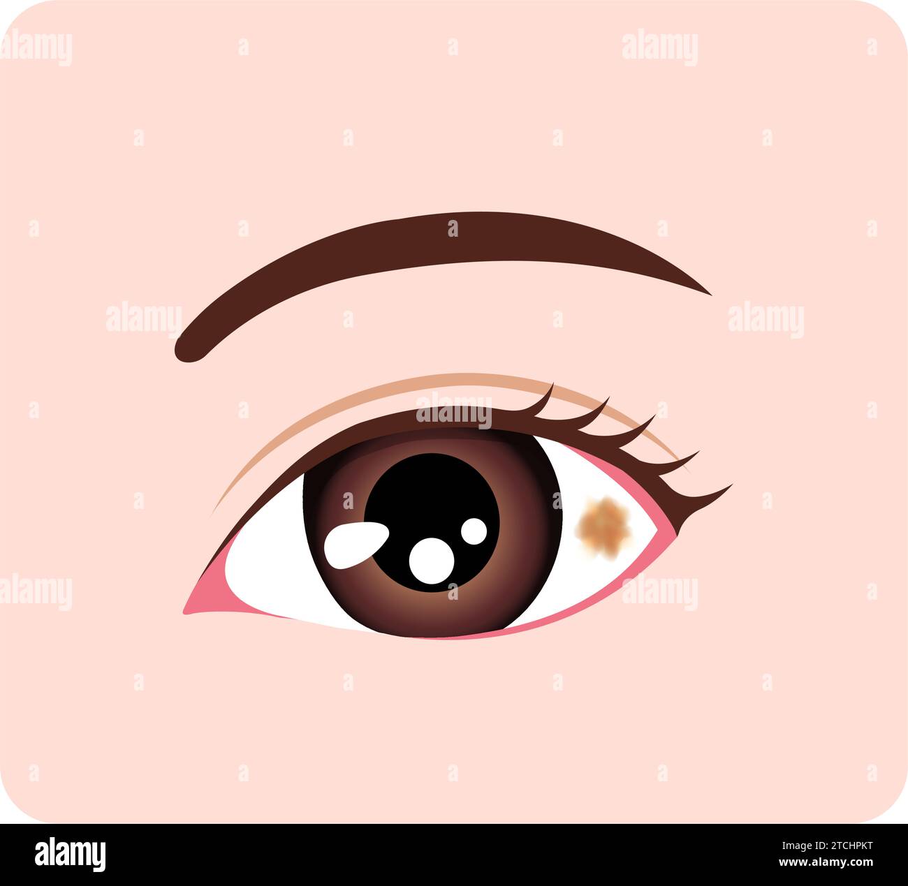 Nevo nevocitico Immagini Vettoriali Stock - Alamy