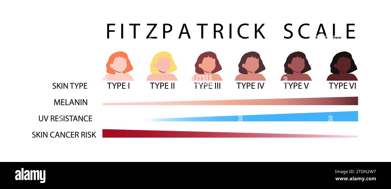 Escala de piel dermis epidermis Immagini Vettoriali Stock - Alamy