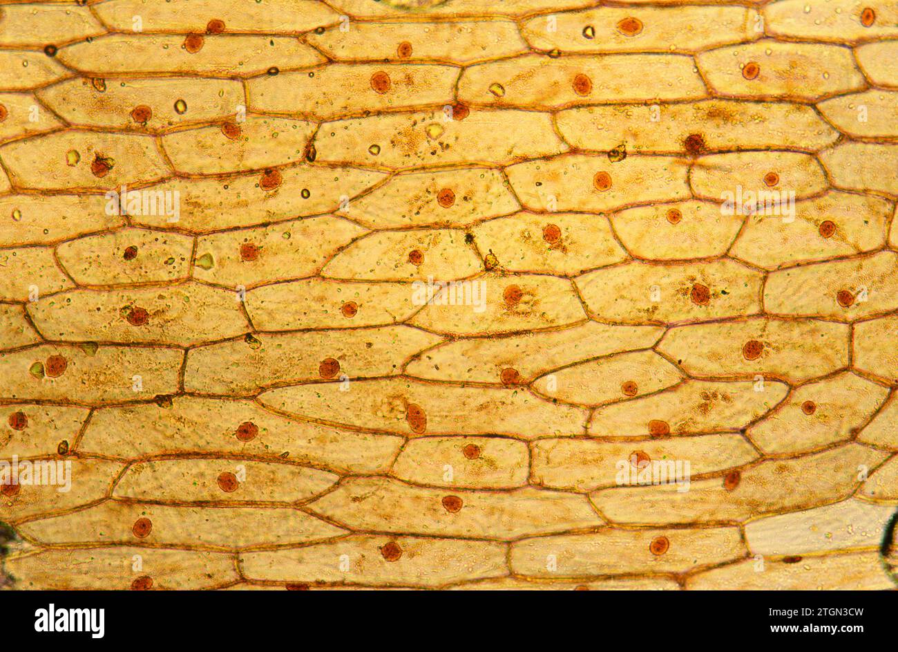 Epidermide cipolla immagini e fotografie stock ad alta risoluzione - Alamy