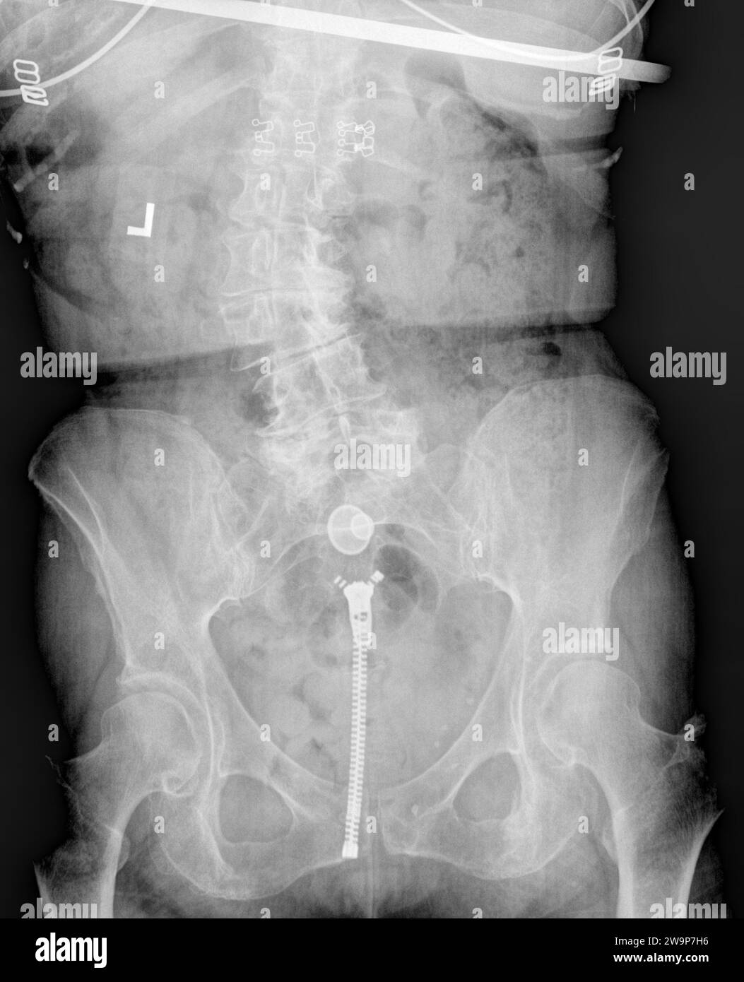 Curva lombare Foto e Immagini Stock in Bianco e Nero - Alamy