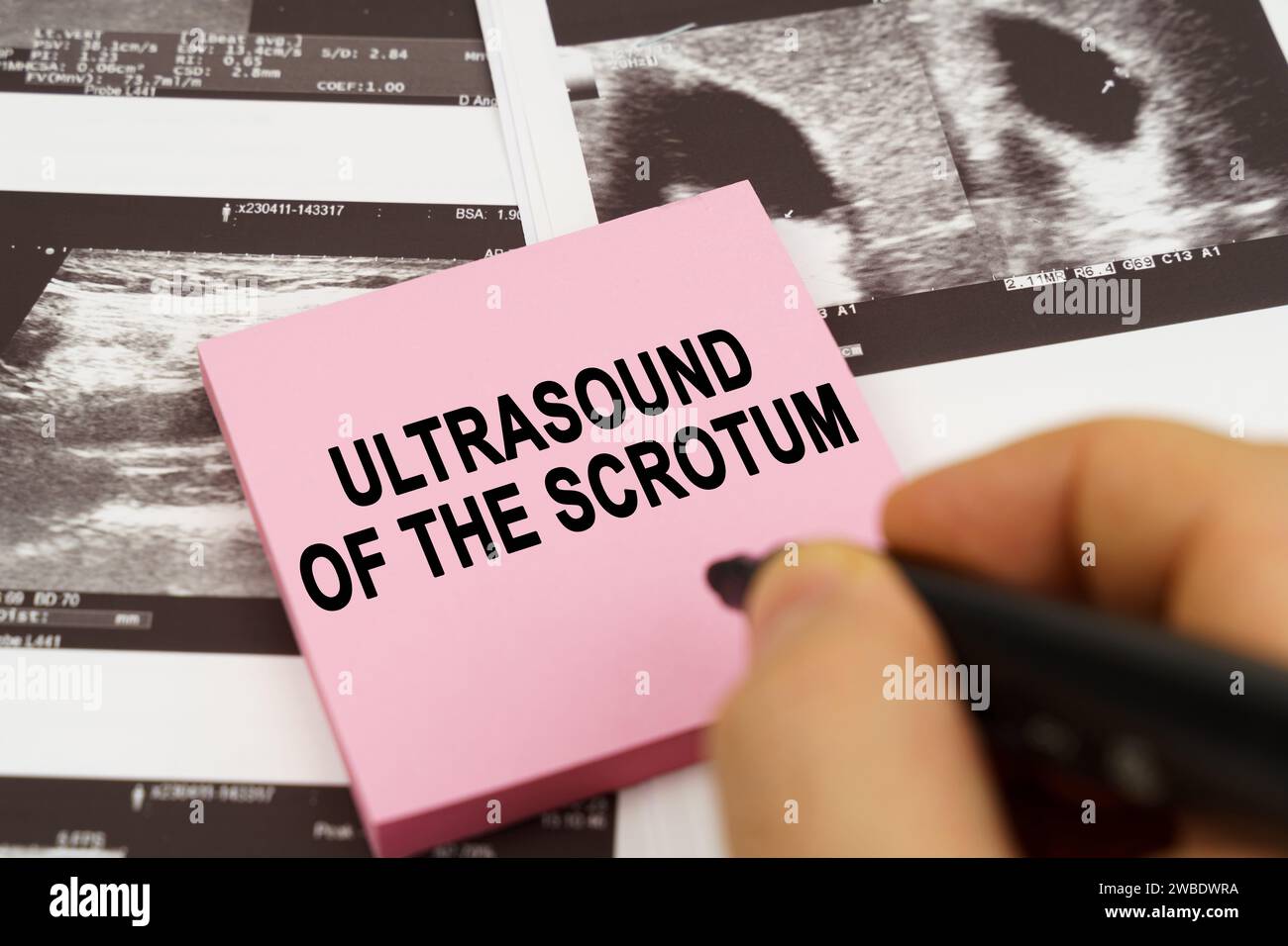 Ecografia dello scroto immagini e fotografie stock ad alta risoluzione ...