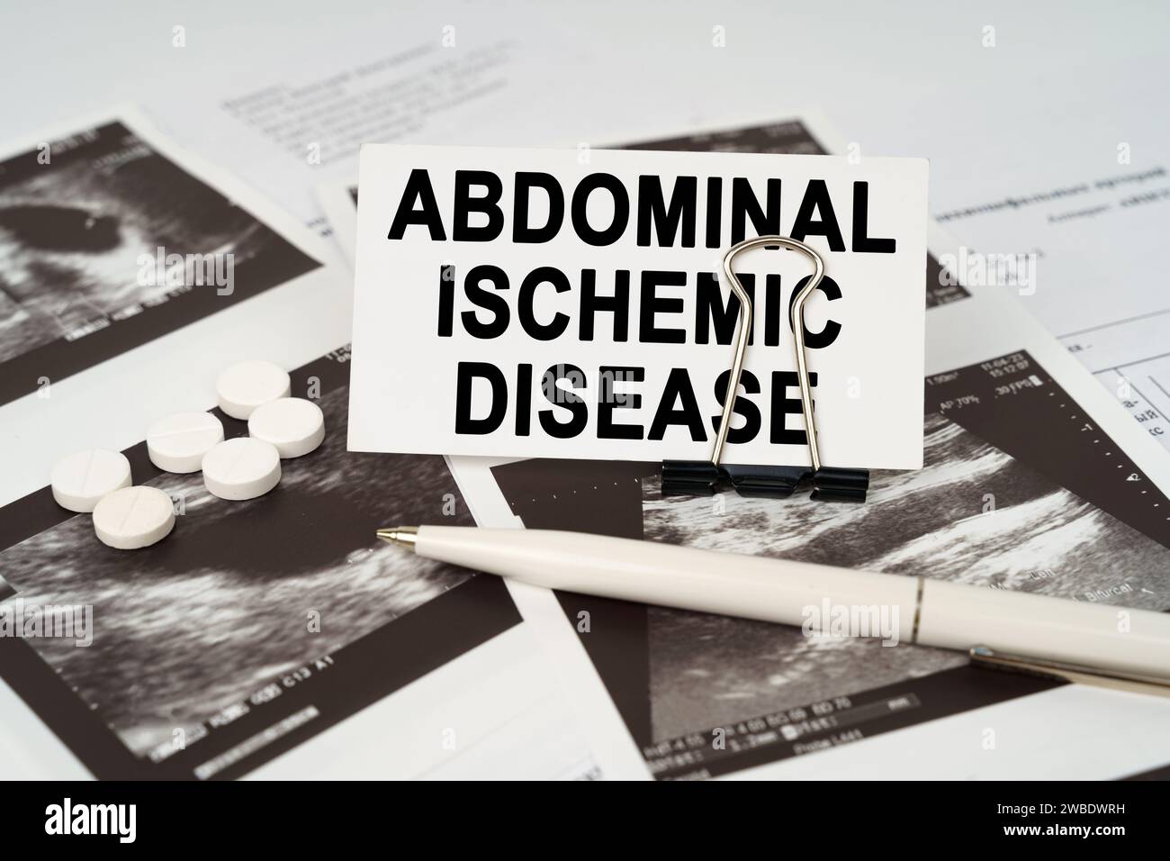 Malattia ischemica addominale immagini e fotografie stock ad alta risoluzione - Alamy