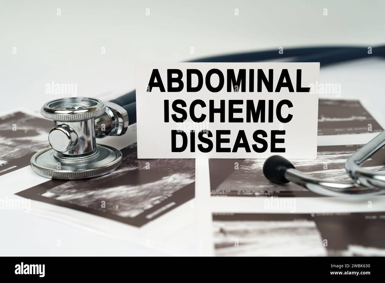 Malattia ischemica addominale immagini e fotografie stock ad alta risoluzione - Alamy