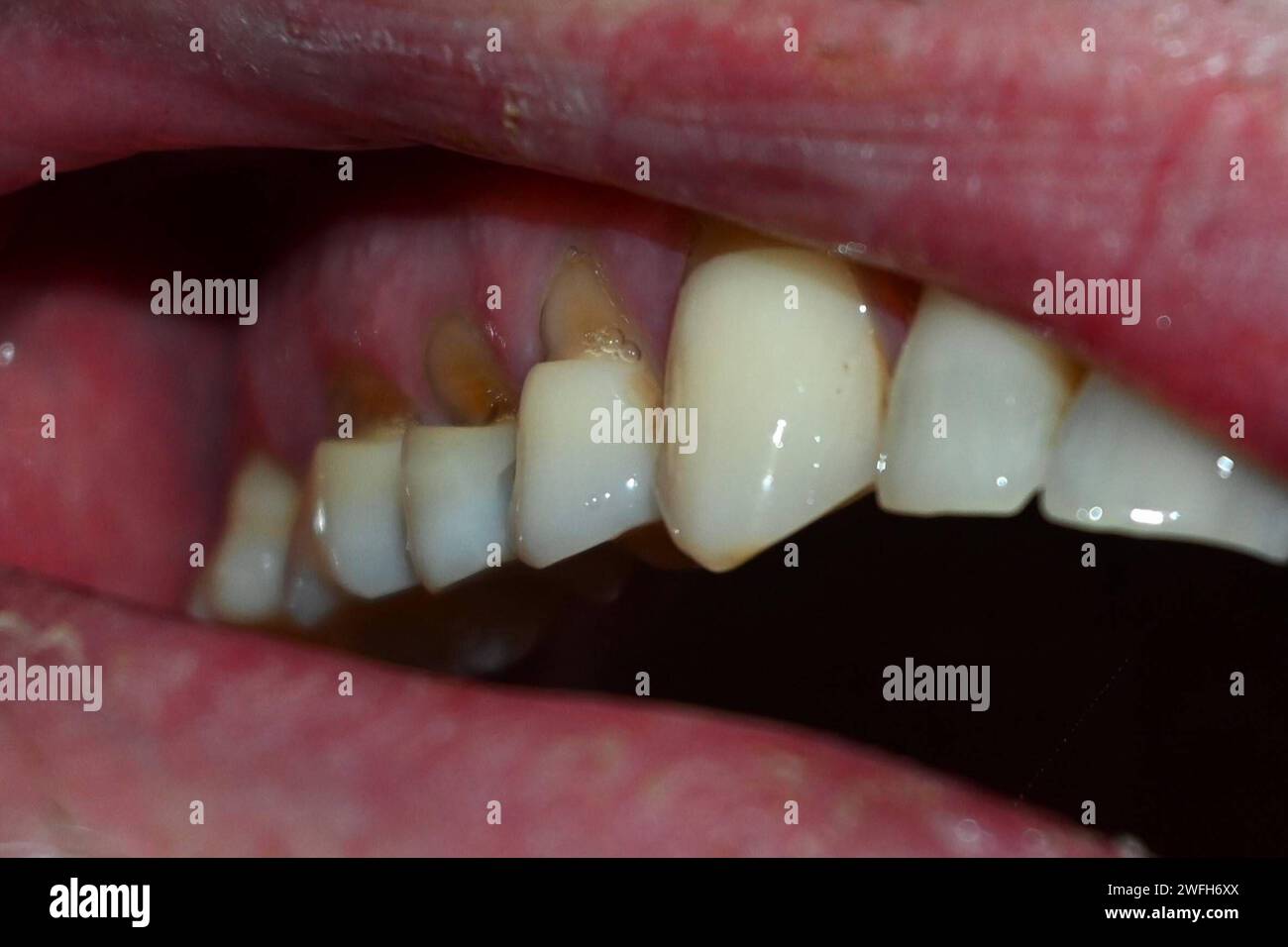 Besuch beim Zahnarzt. Kontrolle der Zähne und Untersuchung auf ...