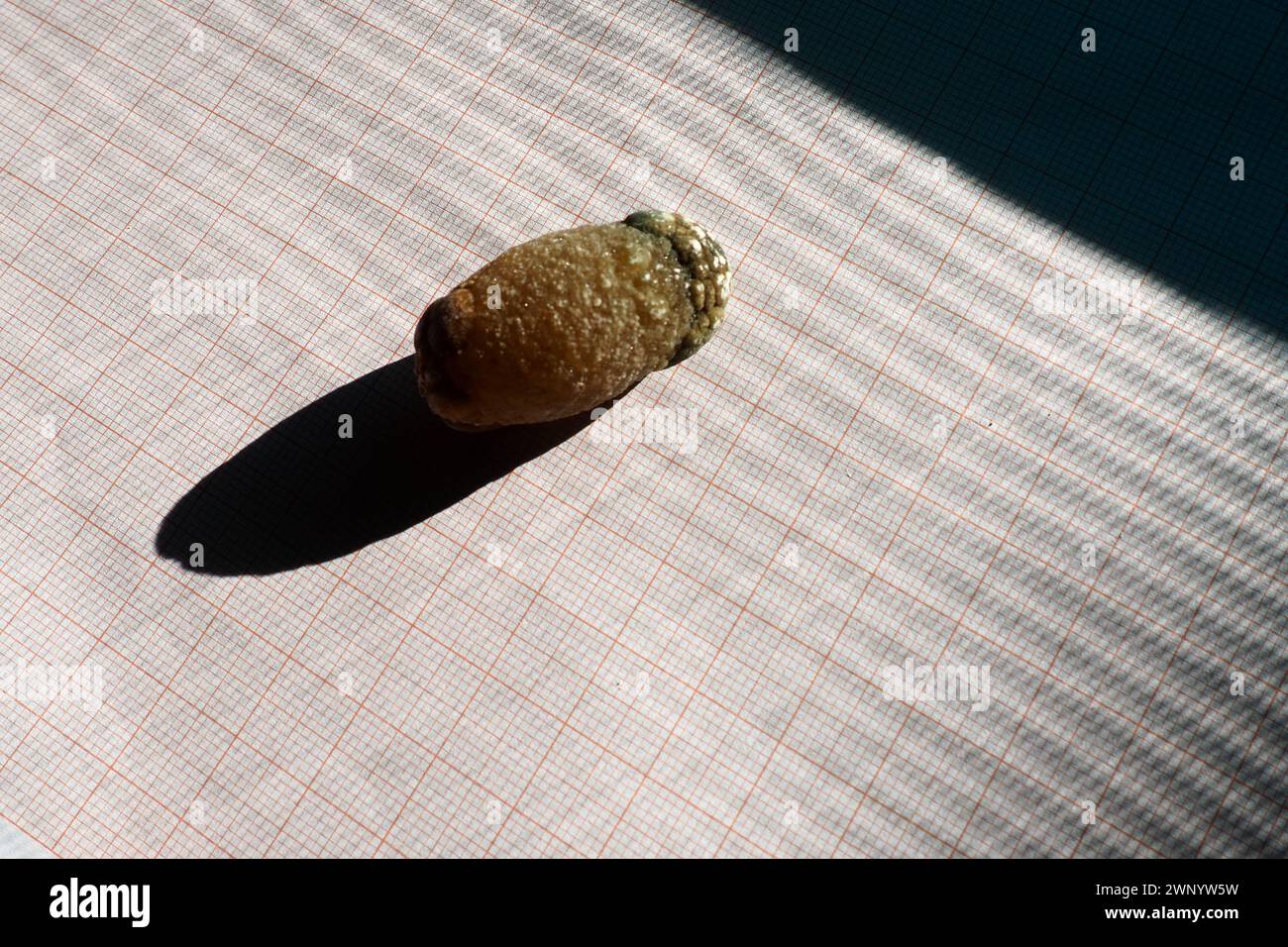 Grosso calcolo biliare immagini e fotografie stock ad alta risoluzione ...