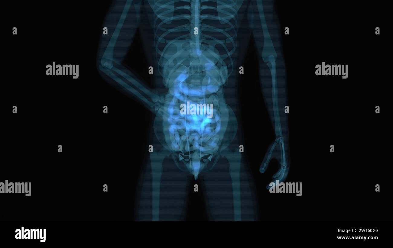 Organi addominali donna anatomia immagini e fotografie stock ad alta ...