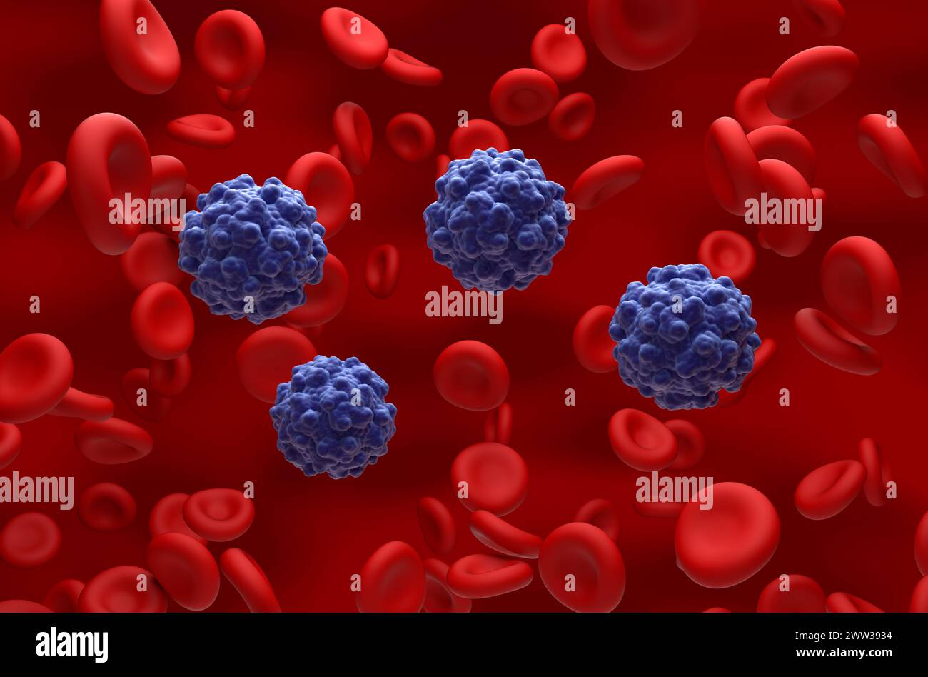 Erythema infectiosum immagini e fotografie stock ad alta risoluzione ...