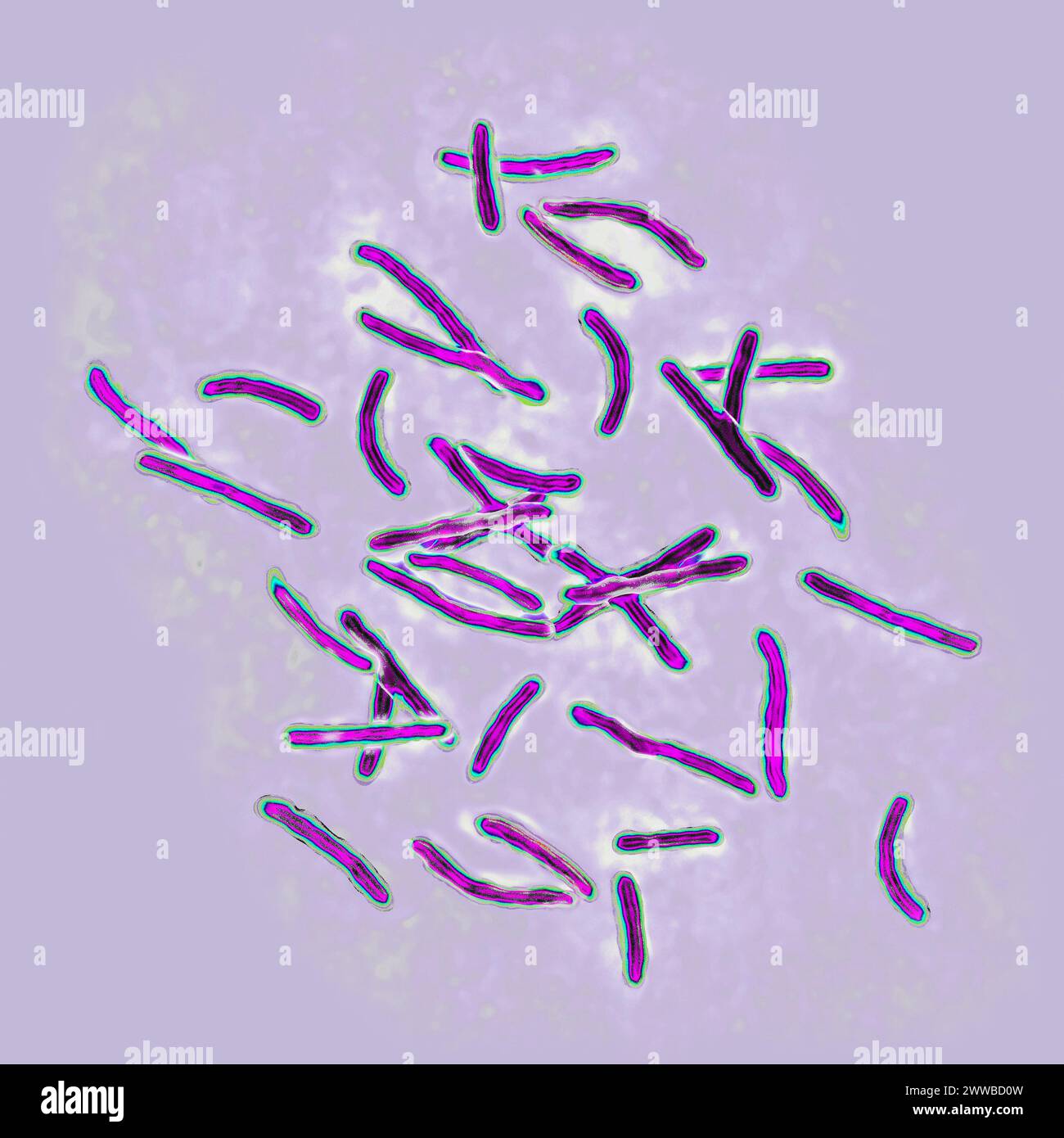 Bacillo di koch immagini e fotografie stock ad alta risoluzione - Alamy